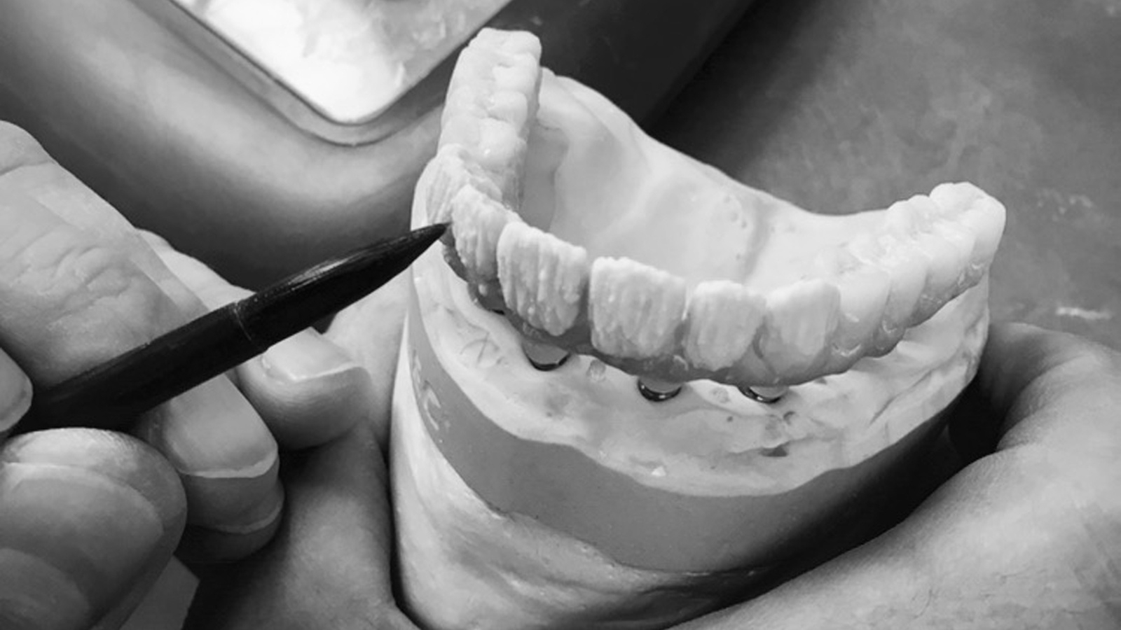 Conjointe | Laboratoire Grall | Prothésiste dentaire | Finistère (29 ...